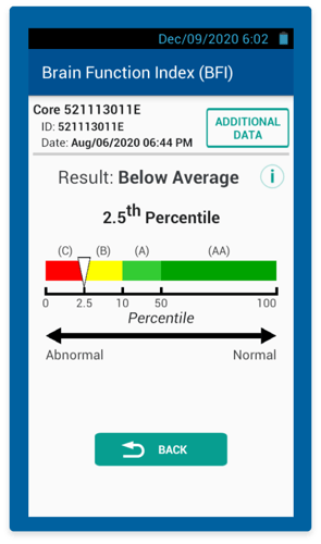 BrainScope for Concussion